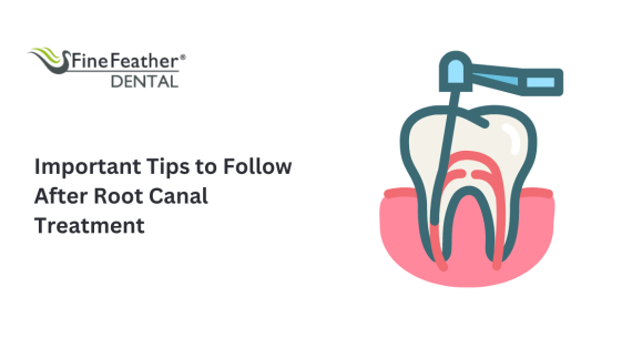 Important Tips to Follow After a Root Canal Treatment - Fine Feather