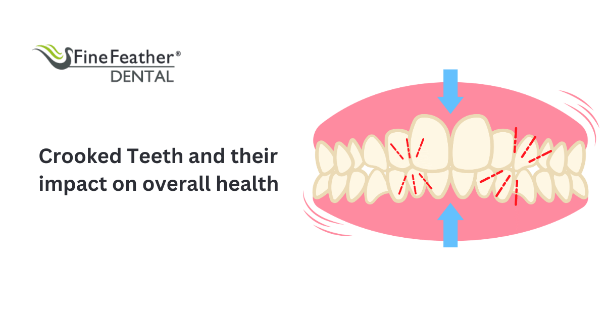 Crooked Teeth & Their Impact On Overall Health | Fine Feather Dental